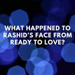 What happened to Rashid’s face from Ready to Love? - Famous People Today